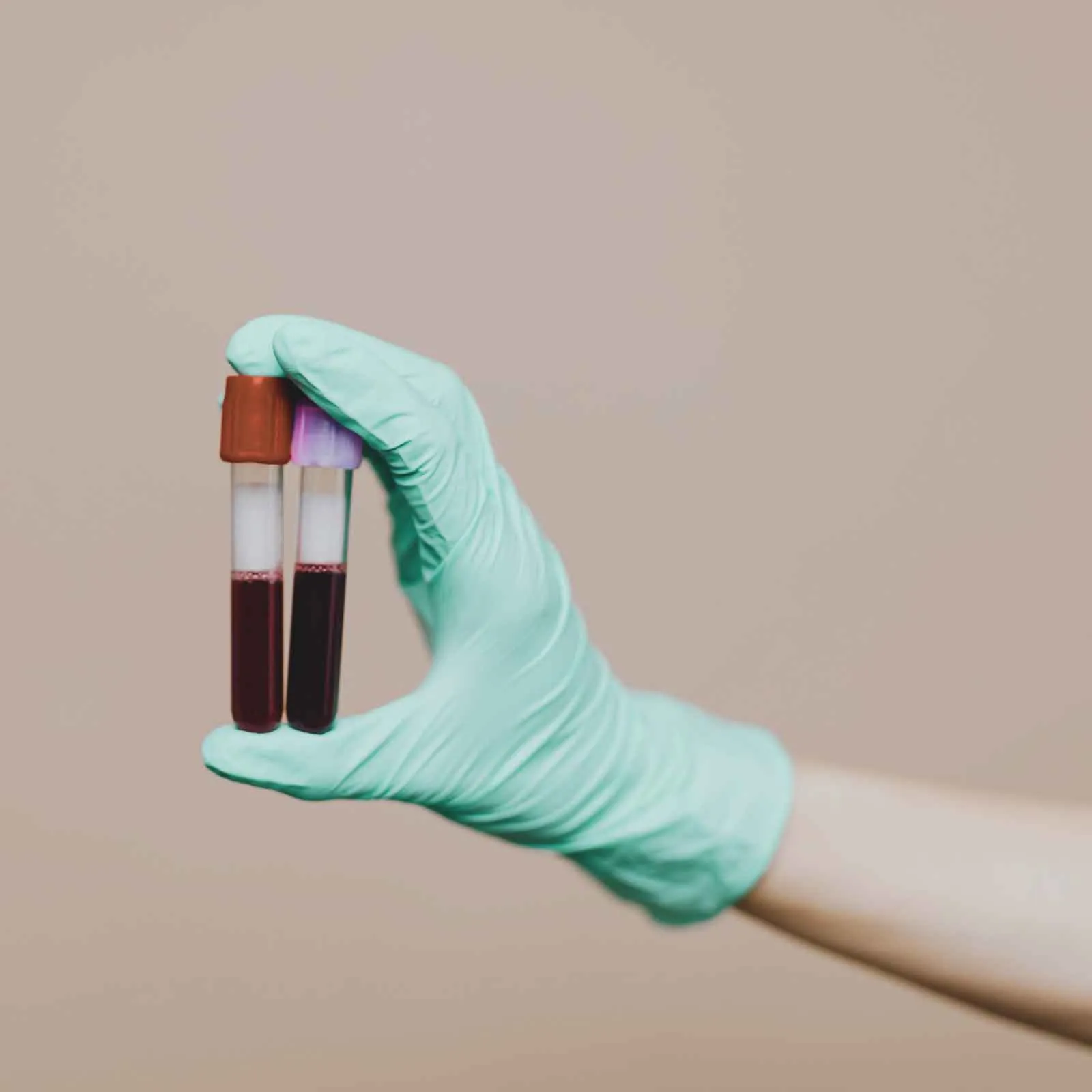 AMH Levels by Age: What Your Ovarian Reserve Numbers Mean